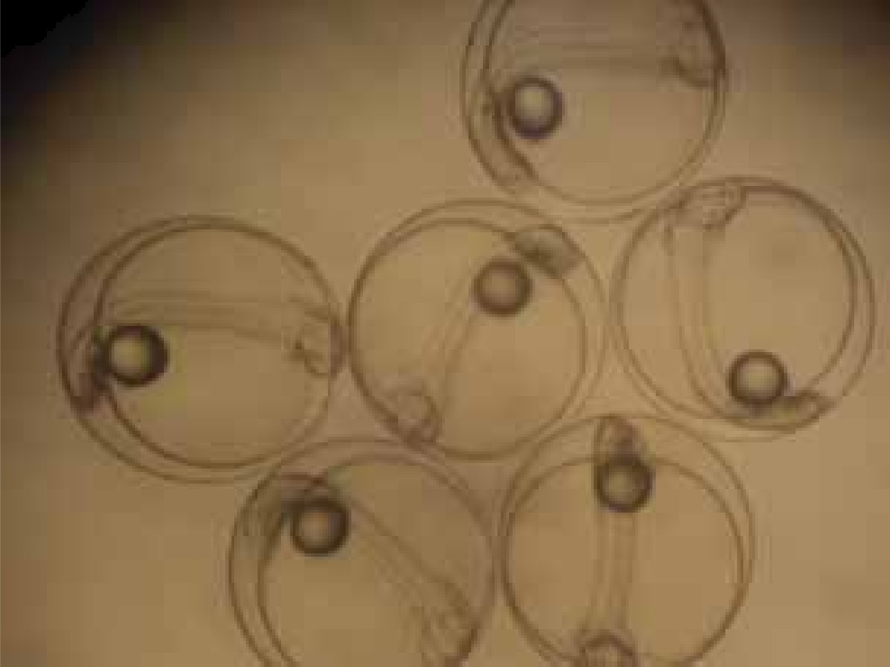 Eyed stage eggs before hatching